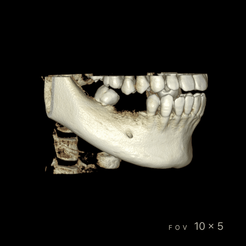 RAY - The Future of Face-Driven Dentistry