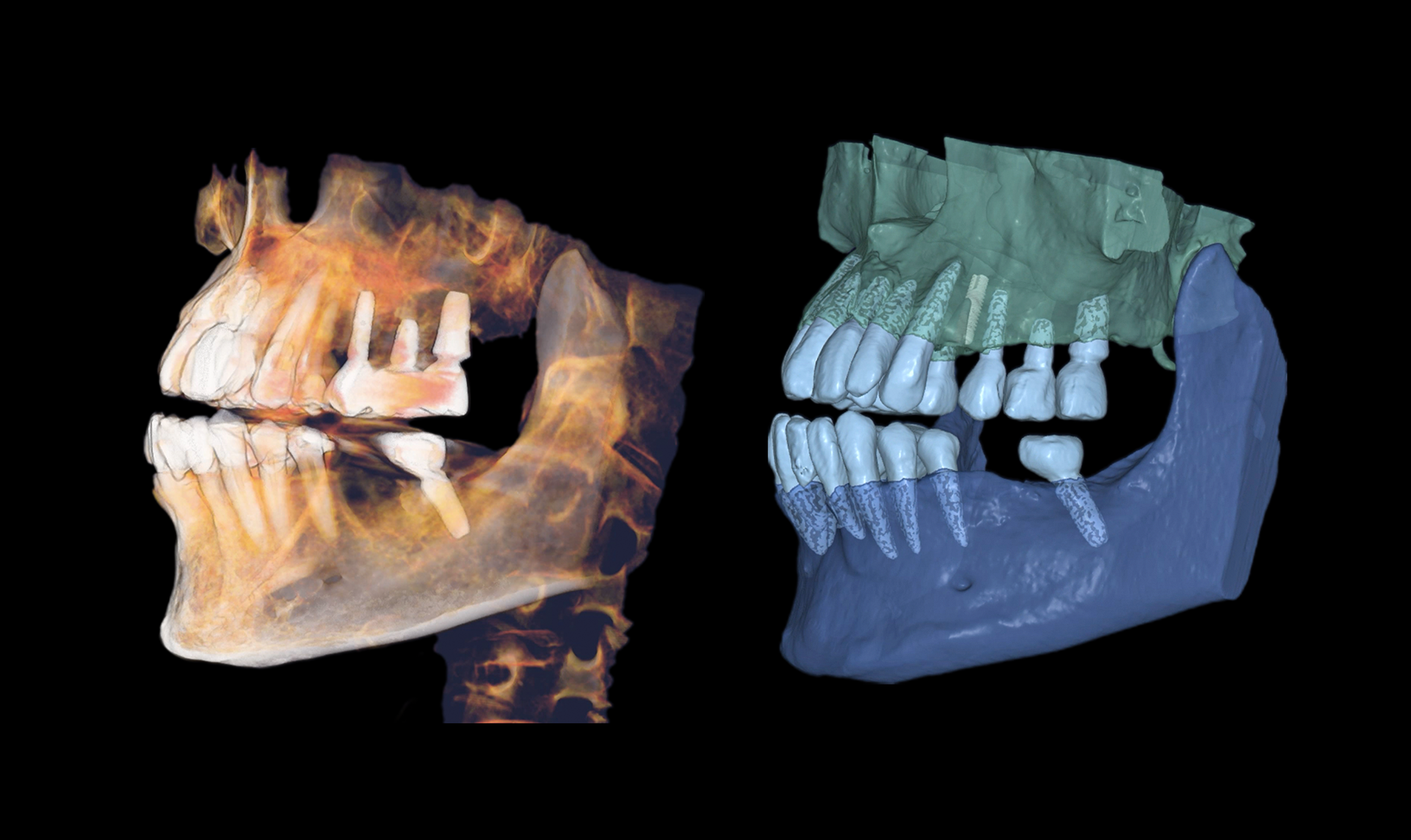 RAY - The Future of Face-Driven Dentistry