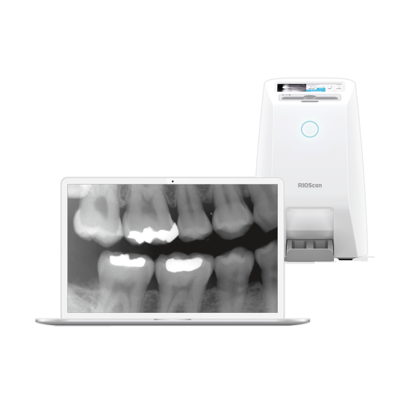 RAY - The Future of Face-Driven Dentistry