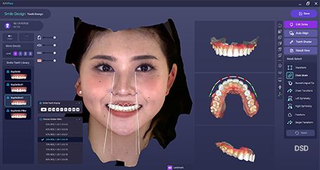 RAY - The Future of Face-Driven Dentistry