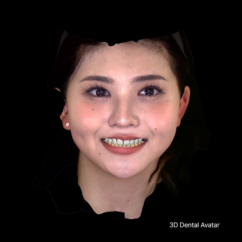 RAY - The Future of Face-Driven Dentistry