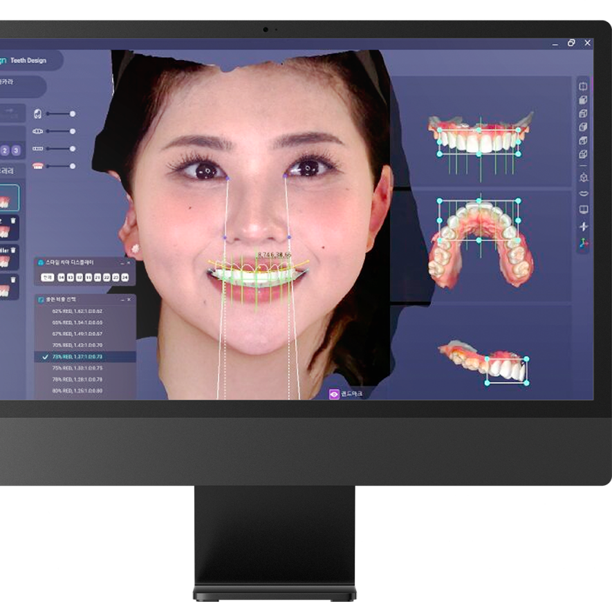 RAY - The Future of Face-Driven Dentistry