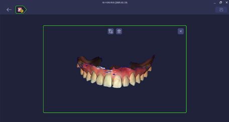 RAY - The Future of Face-Driven Dentistry