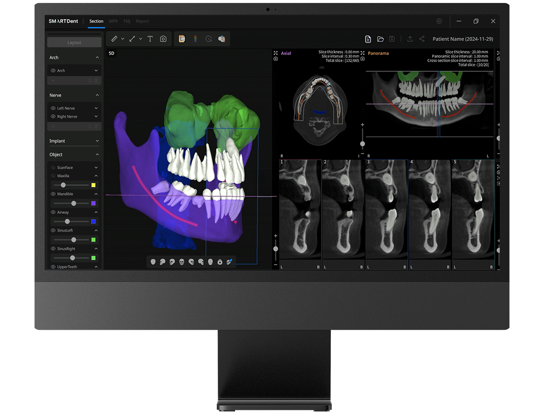 RAY - The Future of Face-Driven Dentistry