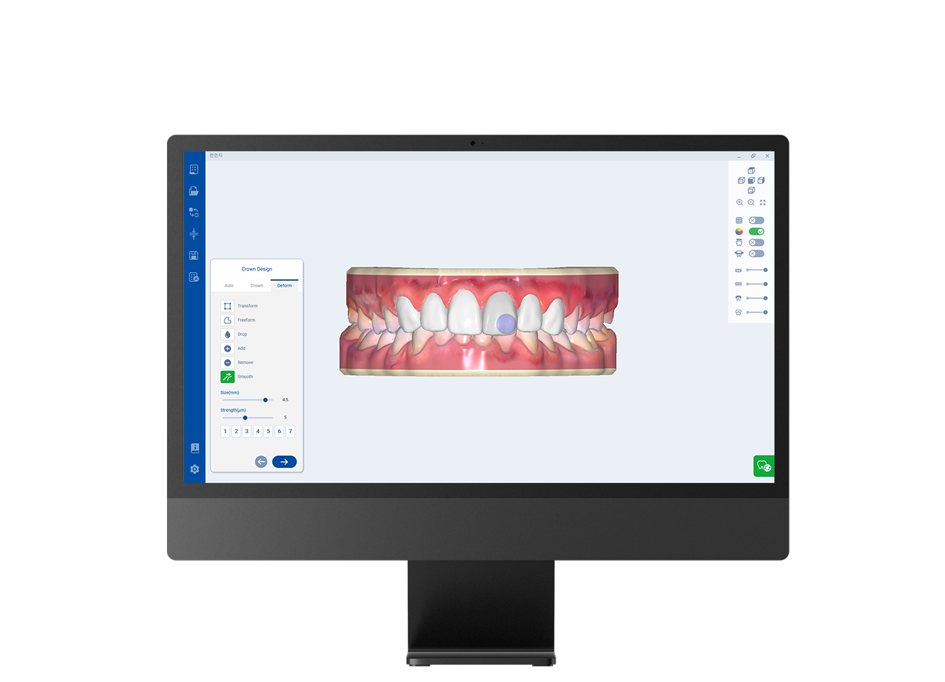 RAY - The Future of Face-Driven Dentistry