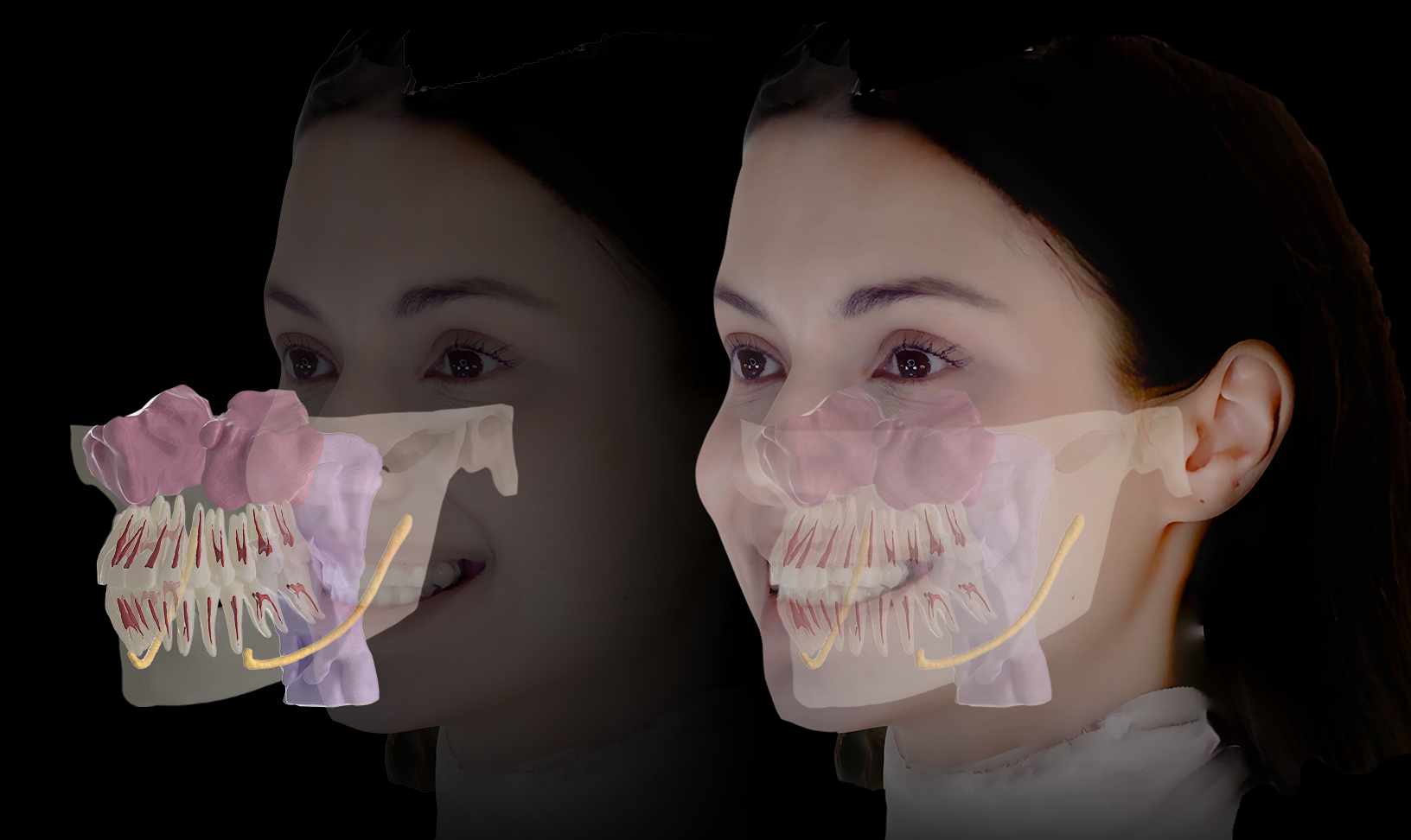RAY - The Future of Face-Driven Dentistry