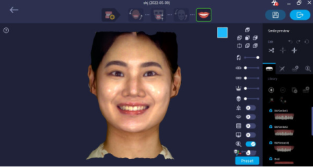 RAY - The Future of Face-Driven Dentistry