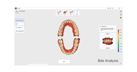 RAY - The Future of Face-Driven Dentistry