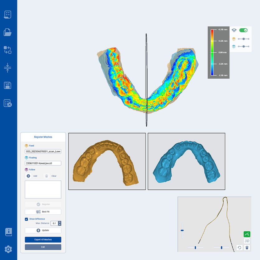 RAY - The Future of Face-Driven Dentistry