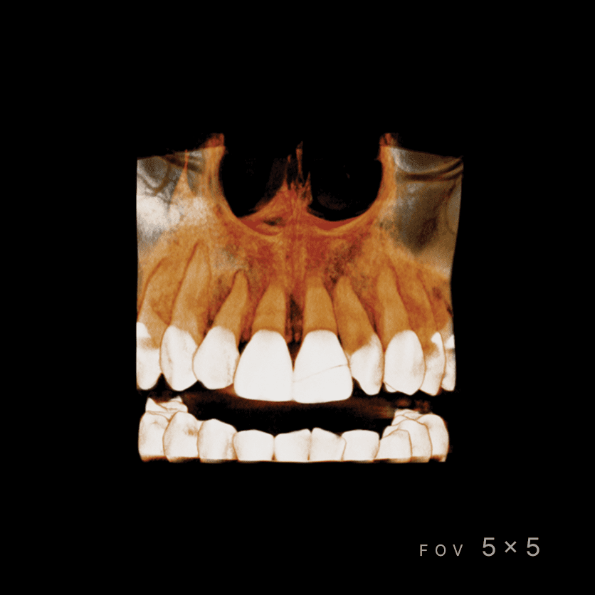 RAY - The Future of Face-Driven Dentistry