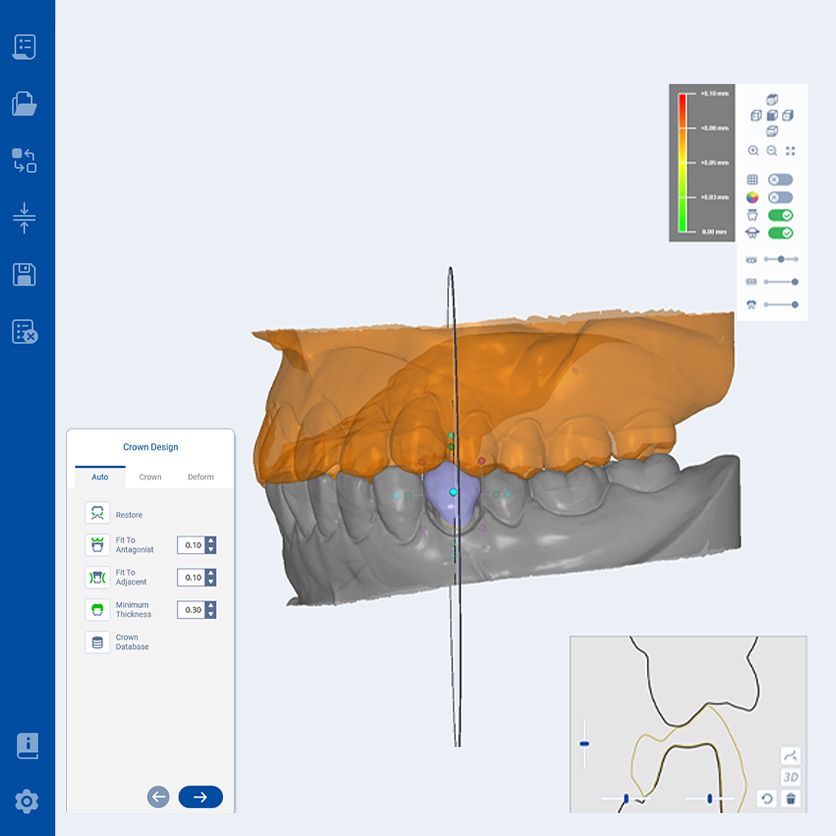RAY - The Future of Face-Driven Dentistry